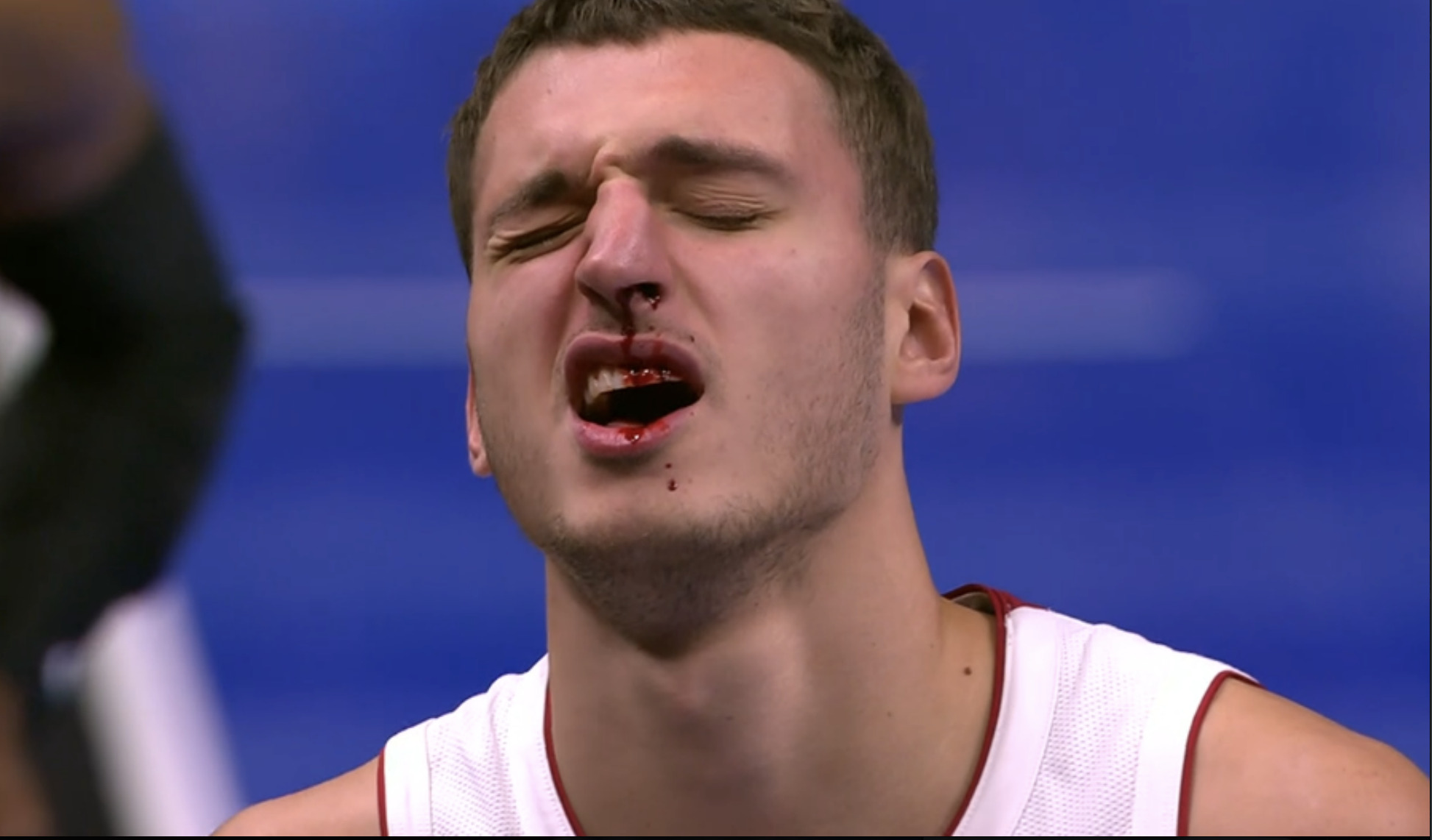 Nikola Jovic (Heat) s'est blessé au nez contre les Pistons